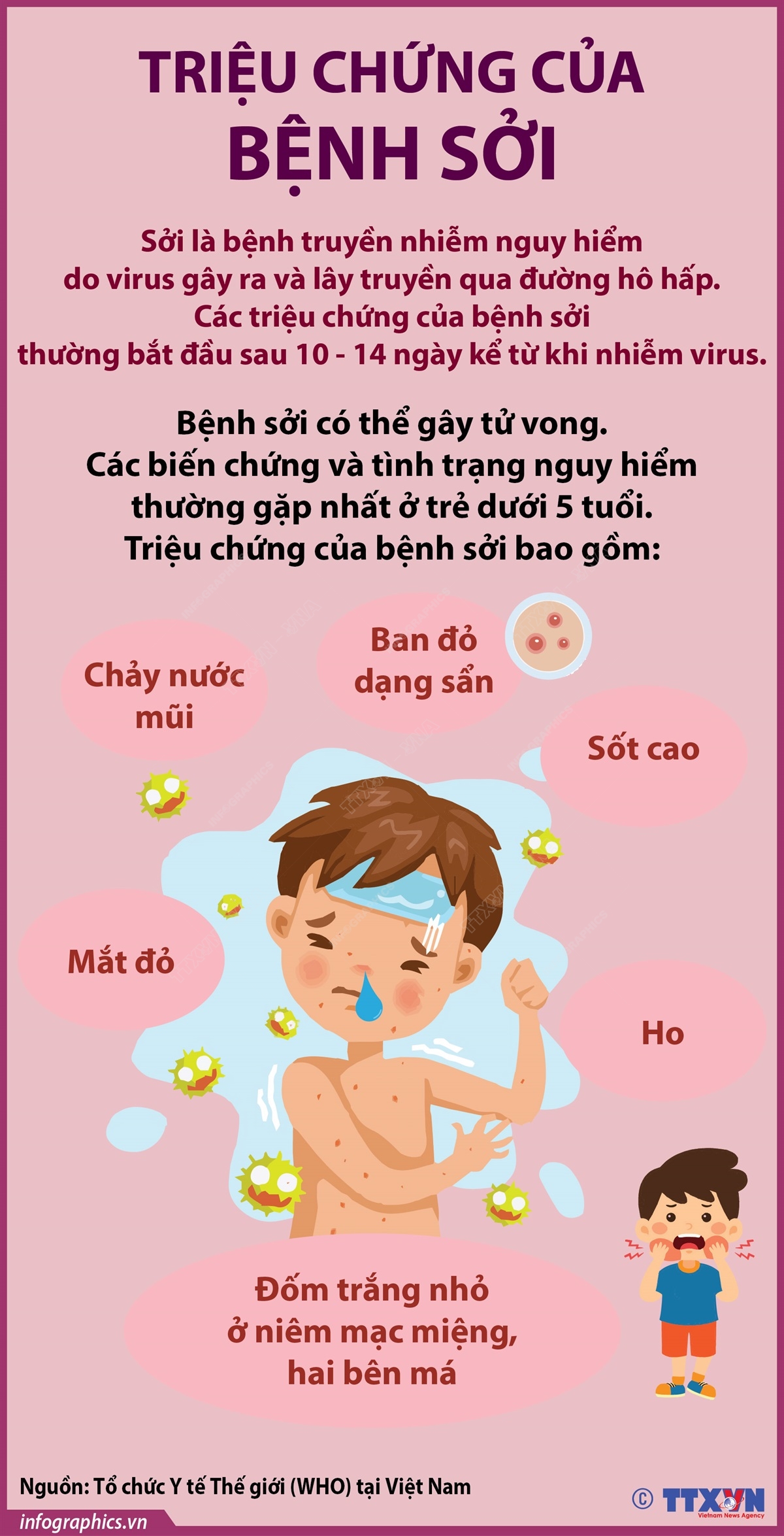 Triệu chứng của bệnh sởi
