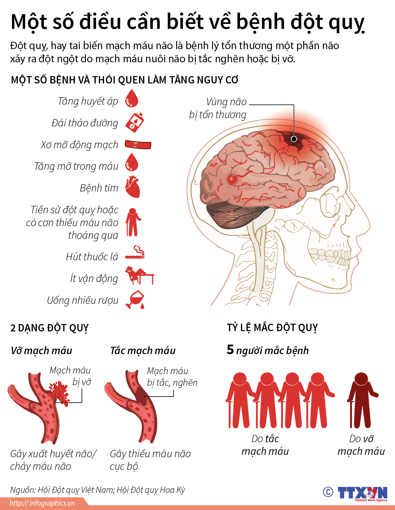 Một số điều cần biết về bệnh đột quỵ